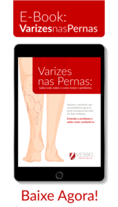 Varizes Pélvicas: Principais Causas, Sintomas e Tratamentos - Vessel